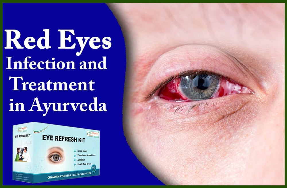 Eyes Infection, Redness | Causes | Symptoms | Medicine and Treatment
