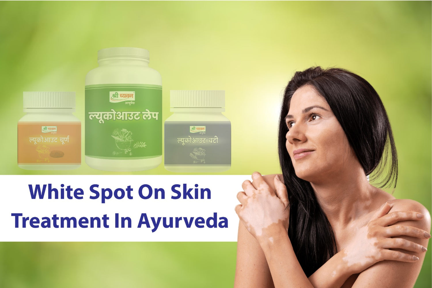 Leucoderma | Vitiligo | Safed Daag Ayurvedic Medicine and Treatment