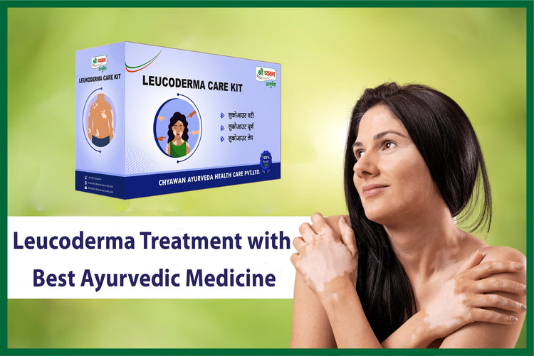 Leucoderma treatment with best ayurvedic medicine, know its benefits