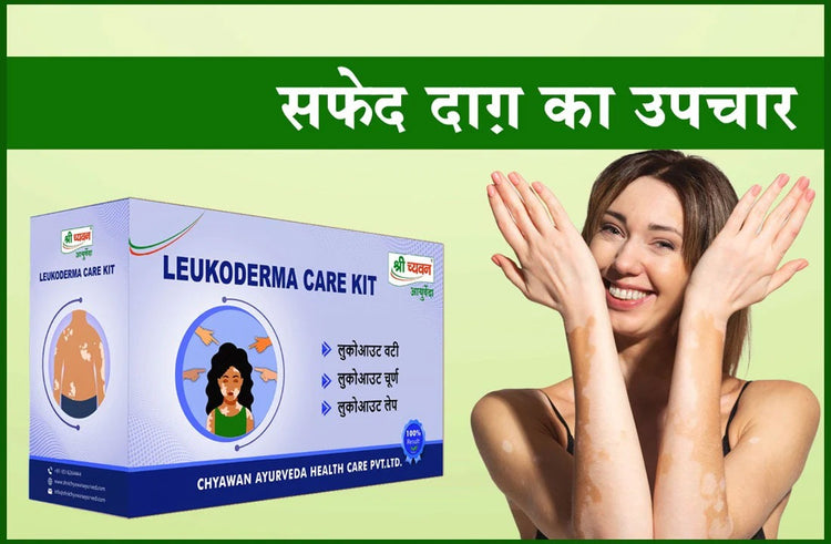 Ayurvedic Medicine for Safed daag or Vitiligo Treatment