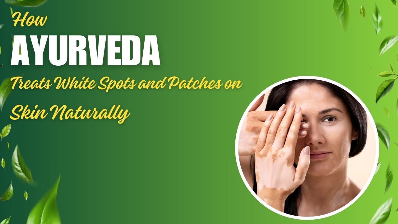 How Ayurveda Treats White Spots and Patches on Skin Naturally