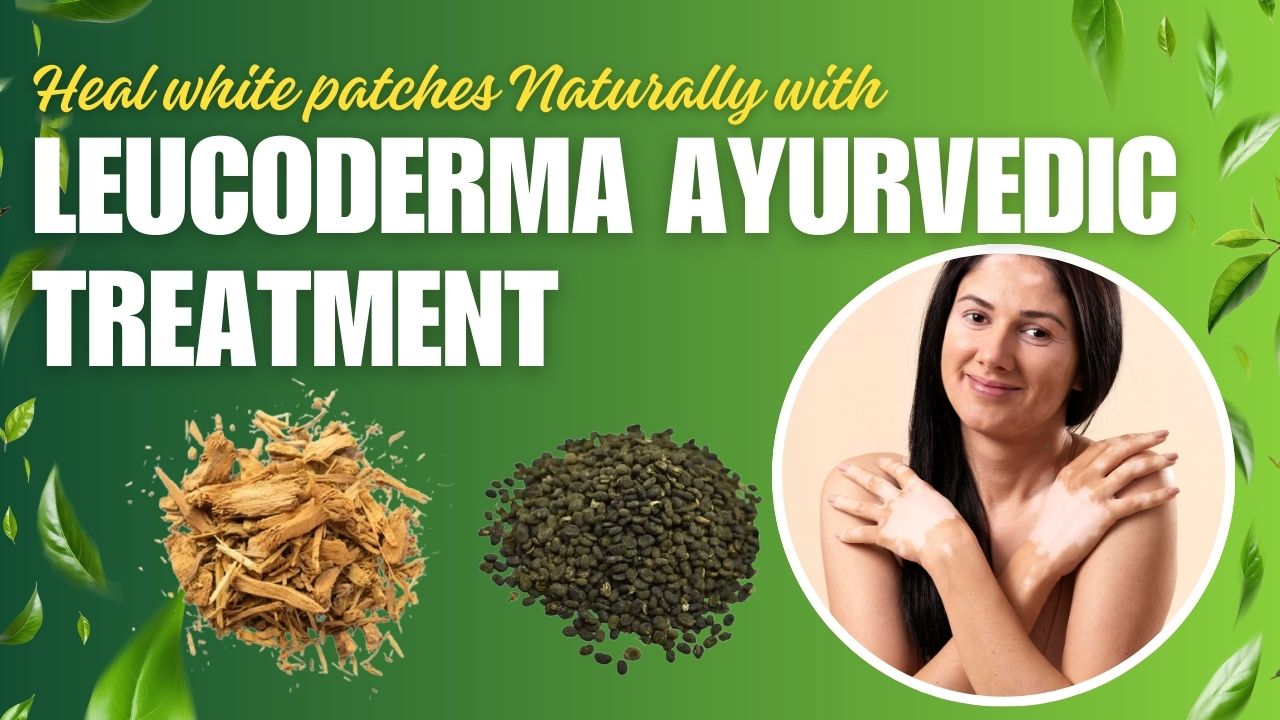 Heal white patches Naturally with Leucoderma Ayurvedic Treatment