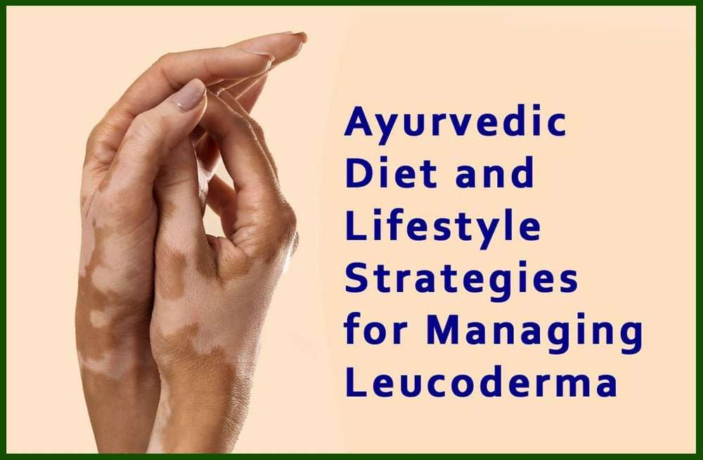 Leucoderma | Vitiligo | Safed Daag Ayurvedic Medicine and Treatment