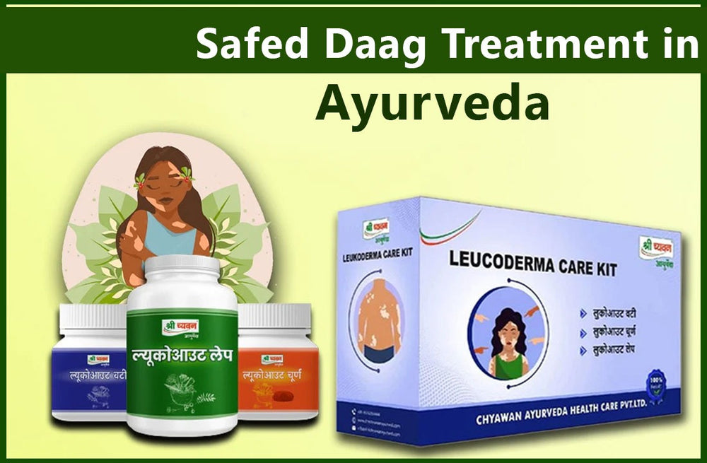 Leucoderma | Vitiligo | Safed Daag Ayurvedic Medicine and Treatment